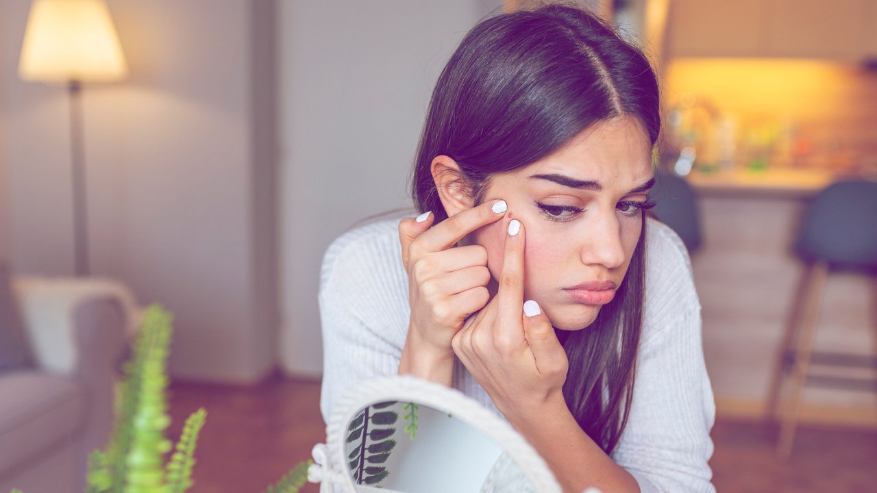 Große Pickel? So wirst du sie schneller los – ohne Narben!