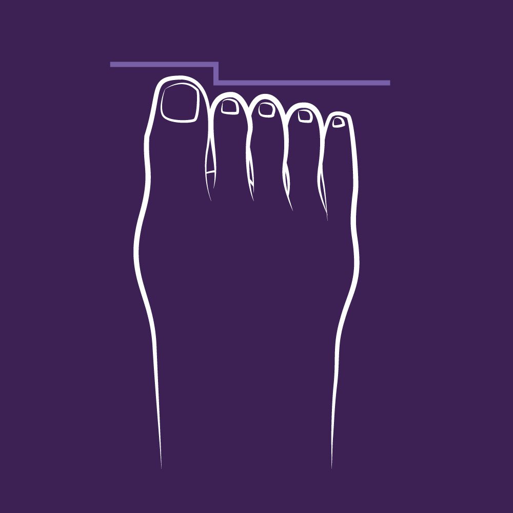 Fußform: Alle 5 Arten und ihre Bedeutung im Überblick