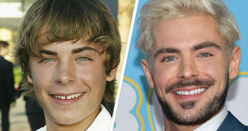 Diese 19 Stars haben gemachte Zähne