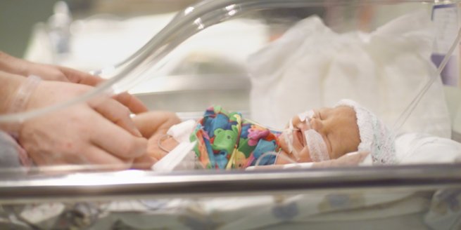 Frühgeburt in der 24. SSW