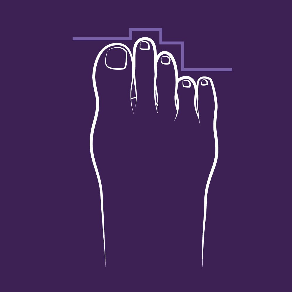 Fußform: Alle 5 Arten und ihre Bedeutung im Überblick