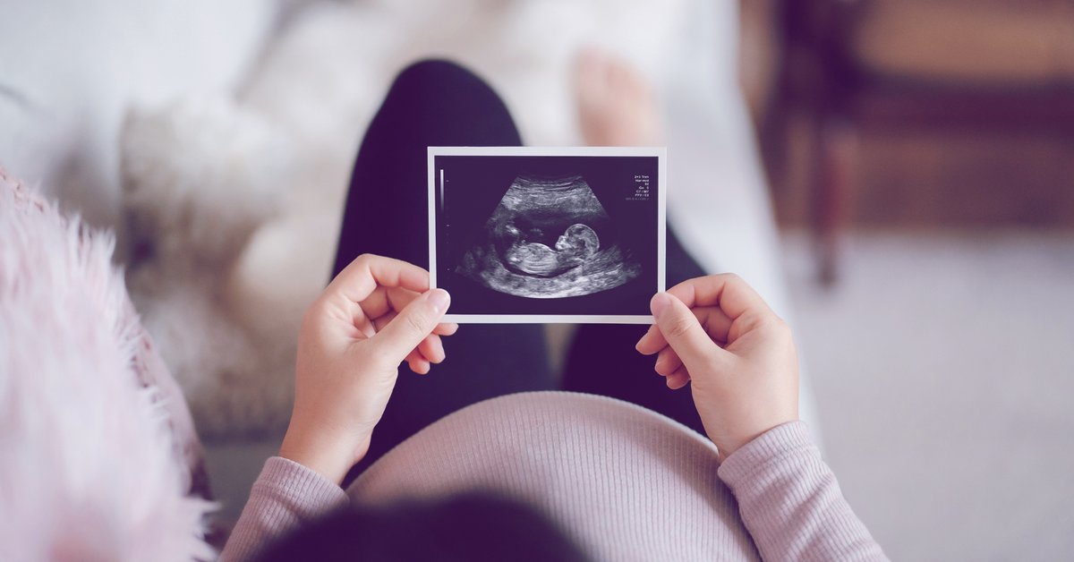 23. SSW: Das Baby nuckelt schon fleißig an seinem Daumen!