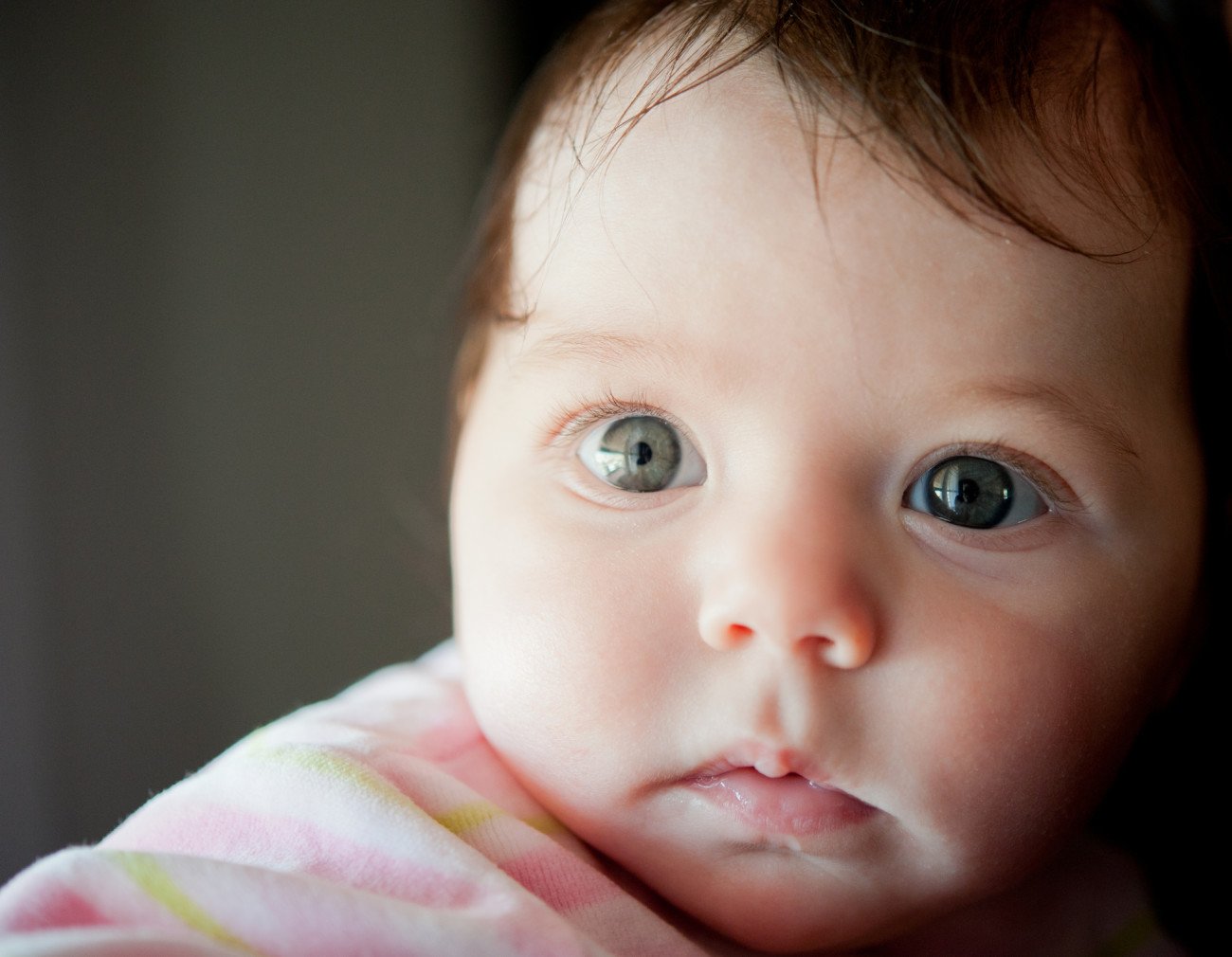 Dennie-Morgan-Falte bei Babys: Was bedeutet sie? | desired.de