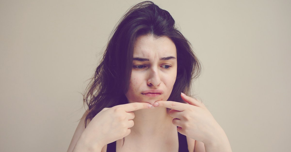 Pickel-Arten: Was sie unterscheidet und wie du sie schnell los wirst!